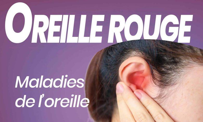 Rougeurs et chaleur aux oreilles : causes et solutions